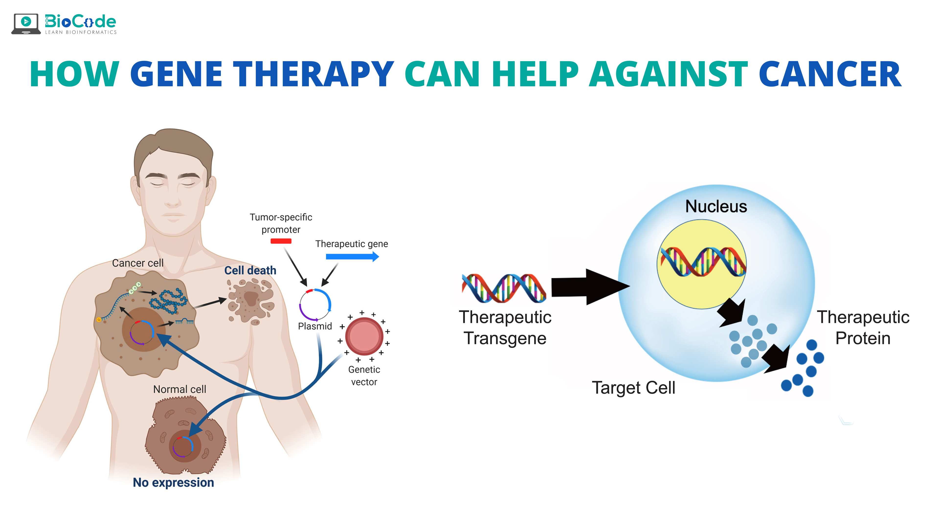 Gene Therapy Cancer